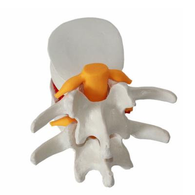 Cina Vertebre 3D Spina cervicale Modello 1.5X Ernia lombare della colonna vertebrale in vendita