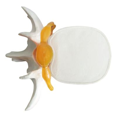 Cina Vertebre 3D Spina cervicale Modello 1.5X Ernia lombare della colonna vertebrale in vendita