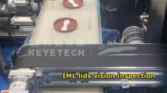 lids vision inspection machine