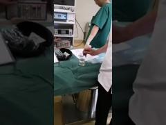 Обработка лазера гольмия оториноларингологии носовых полипов и Papilloma горла