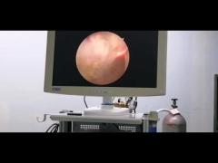 Precision Coblation Plasma Surgery System voor Urologie BPH Operaties