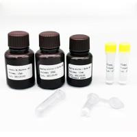 China clinical Nucleic Acid Extraction System , Nucleic Acid Isolation Kit Spin Column Method for sale