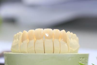 Cina Corona dentaria di grande di biocompatibilità biossido di zirconio pieno di contorno in vendita