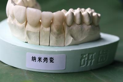 China ISO13485 de goede Kostbare Tandkroon van Biocompatibility PFM niet Te koop