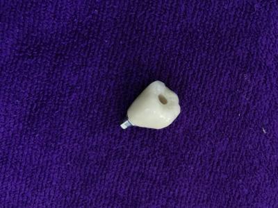 Cina Grande corona di sostegno dell'impianto dentario di biocompatibilità ANKYLOS in vendita