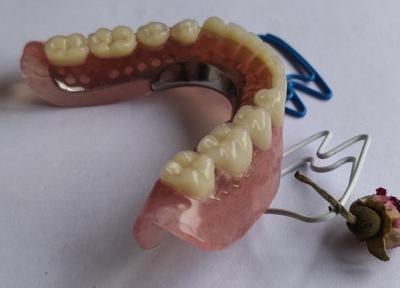 Cina Impianto completo Overdenture di Straumann ISO13485 in vendita