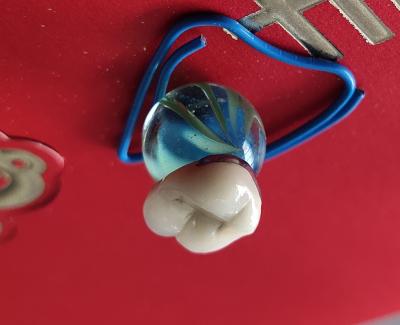 Cina Porcellana dentaria della corona di camma PFM del prodotto cad del laboratorio fusa a metallo in vendita