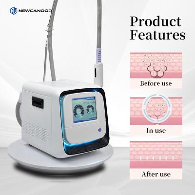 Cina Macchina di rimozione del pigmento laser portatile Q Switch Pico Laser Rimozione del tatuaggio in vendita