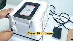 980nm Laser Spider Vein Skin Tag Removal Machine