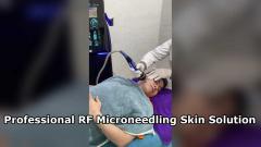 Ice Gold RF Microneedling Machine for Professional Skin Care