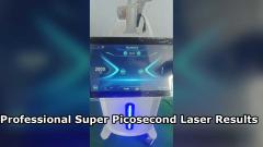 Professional Super Picosecond Laser for Tattoo Removal