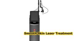 Fractional CO2 Laser Skin Resurfacing Scar Treatment