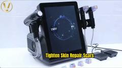EMRF M8 Gold RF Microneedling Skin Tightening Scar Repair