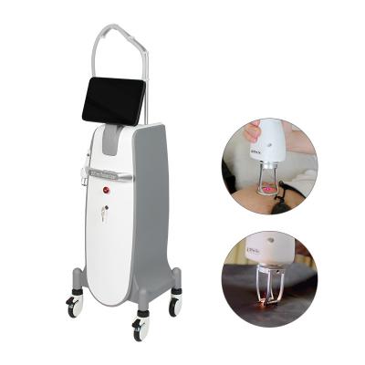 China Vertical Model 1927nm Thulium Laser Machine for Pigmentation & Skin Brightening for sale