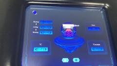 Cryolipolysis machine screen and handle in operation