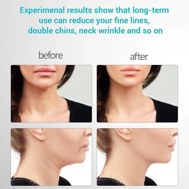 Neck Rejuvenation Device Image 3