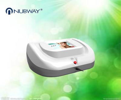 China 2017 latest spider vein removal machine 30MHz for sale