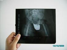 Cina carta medica dei raggi x del film di 35cm * di 28cm per la stampante a laser KND-DRYTEC-3000 in vendita