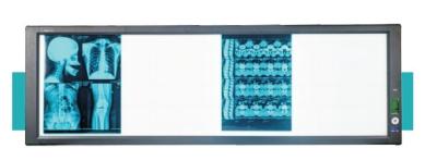 Caja de visualización médica con LED superbrillante