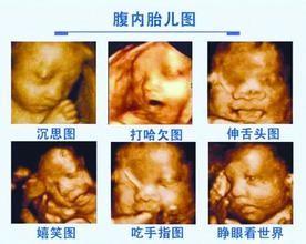 China Medical 3D / 4D Color Doppler Ultrasound System Portable With 15 inch LED Monitor for sale