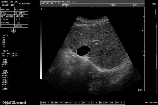 SRA Large Animal Veterinary Ultrasound Machine 64G 12 Inch LCD Display 8