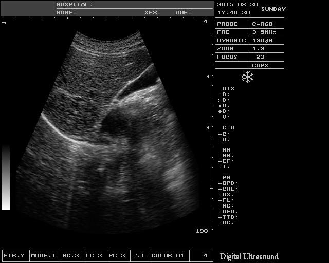 TGC Control Notebook Ultrasound Scanner For Pregnancy Home Use 10