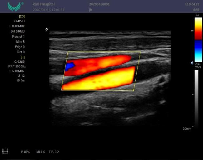 Modo addominale 6 di PW CFM PDI della macchina di ultrasuono di doppler di ricerca della classe II