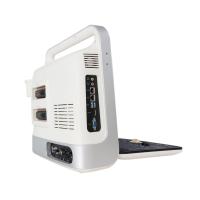 China 15 inch Portable Diagnostic Ultrasound Machine with 8 TGC Control and Convex Linear Probe for sale