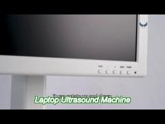 OBの病院医院のための携帯用超音波機械耐久220V