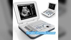Portable Ultrasound Scanner DRF RDA Rechargeable