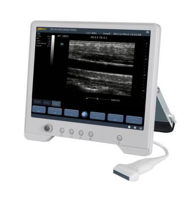 China Digital Diagnostic Portable Ultrasound Machine For Pregnancy Gynecology Department for sale