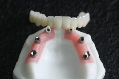 China Aesthetic and Biocompatible Zirconia Crown and Abutment for Strong Dental Restoration for sale