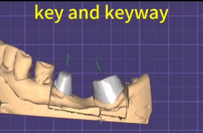 China Key and Keyway for Common Path of Insertion with Precision Fit and Durable Construction for sale