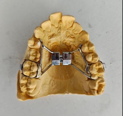 China Biocompatible Stainless Steel Dental Expander for Clinically Proven Arch Expansion with Custom-Fitted Comfort for sale