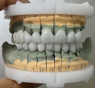China Full Zirconia dental bridge for high strength and durable dental restoration for sale
