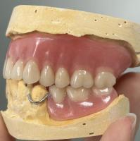 China Full Arch Denture for sale
