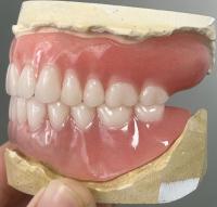 China Full Arch Denture for sale