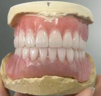 China Full Arch Denture for sale