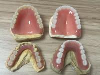 China Full Arch Denture for sale