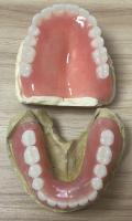 China Full Arch Denture for sale