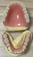 China Full Arch Denture for sale