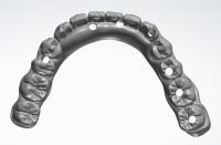China Digital Aluminum Bar with Temporary Teeth for Dental Study Models for sale