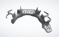 China Digital Metal Frame for Precision Applications and Durable Construction for sale