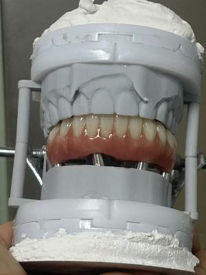 China Monolithic Zirconia Implant Bridge for Full Arch Restoration with CAD/CAM Precision for sale