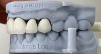 China Full Zirconia for sale