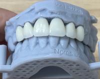 China Full Zirconia for sale