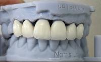 China Full Zirconia for sale