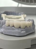 China Full Zirconia for sale