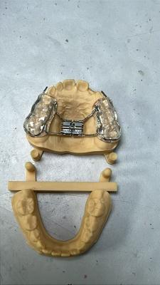 China Custom Orthodontic Appliances  for Personalized Treatment for sale