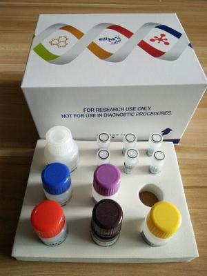 China Human prolactin (PRL) ELISA Kit for sale